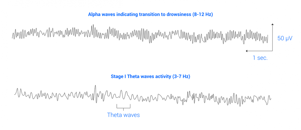 Sleep EEG for Diagnosis and Research | Bitbrain